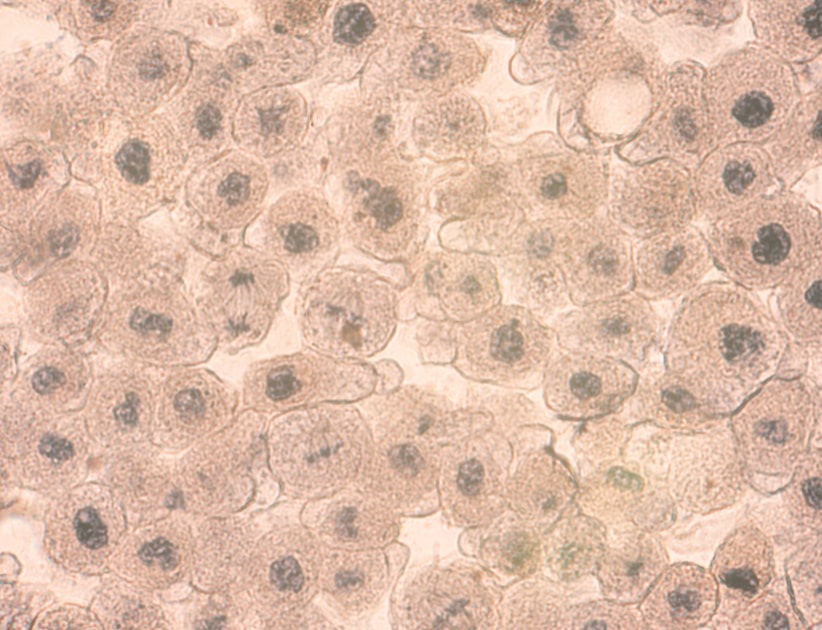 Las células epiteliales se vuelven curvas para adquirir una estructura ...