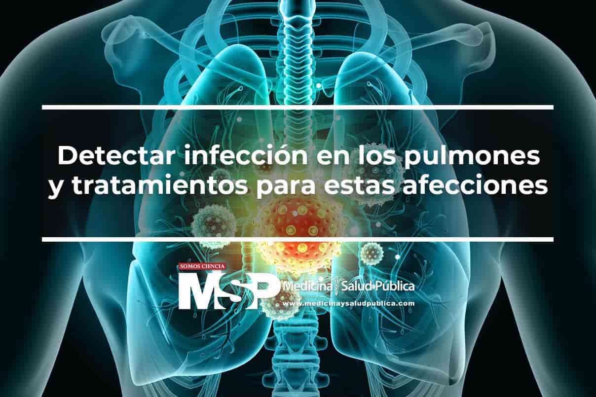 Detectar infección en los pulmones y tratamientos para estas afecciones