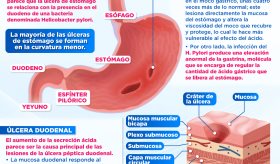 Gastroenterología | Medicina y Salud Pública