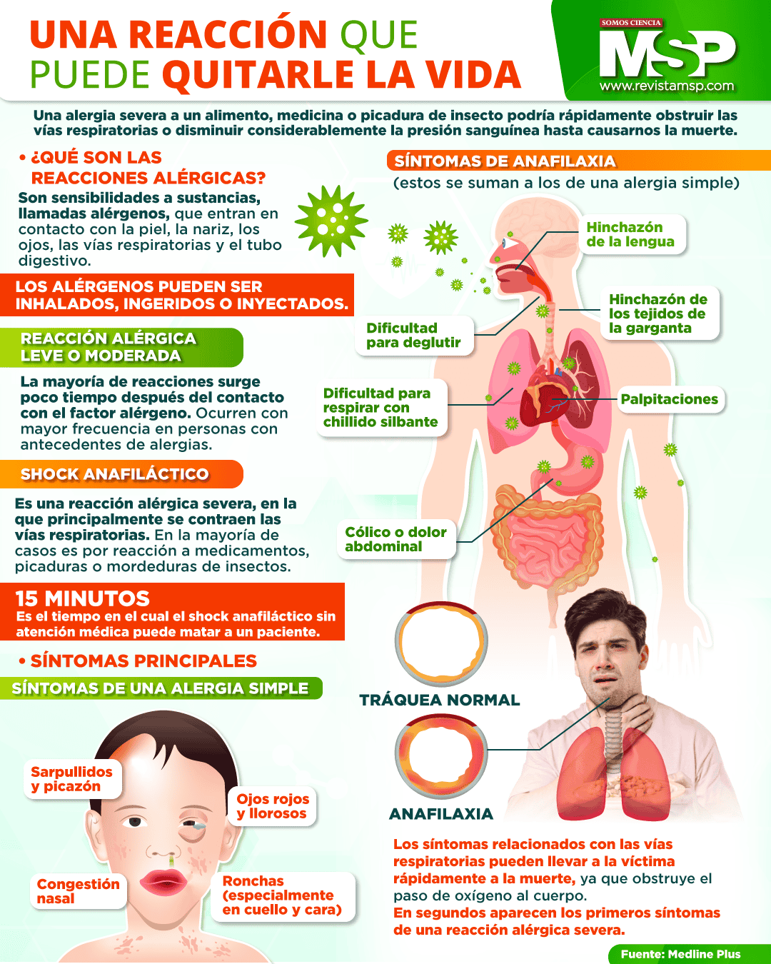Una reacción alérgica que puede quitarle la vida