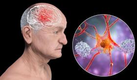 Dr. José Yovín Vargas: Un médico comprometido con la Salud Pública de ...