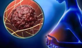 Dr. José Yovín Vargas: Un médico comprometido con la Salud Pública de ...