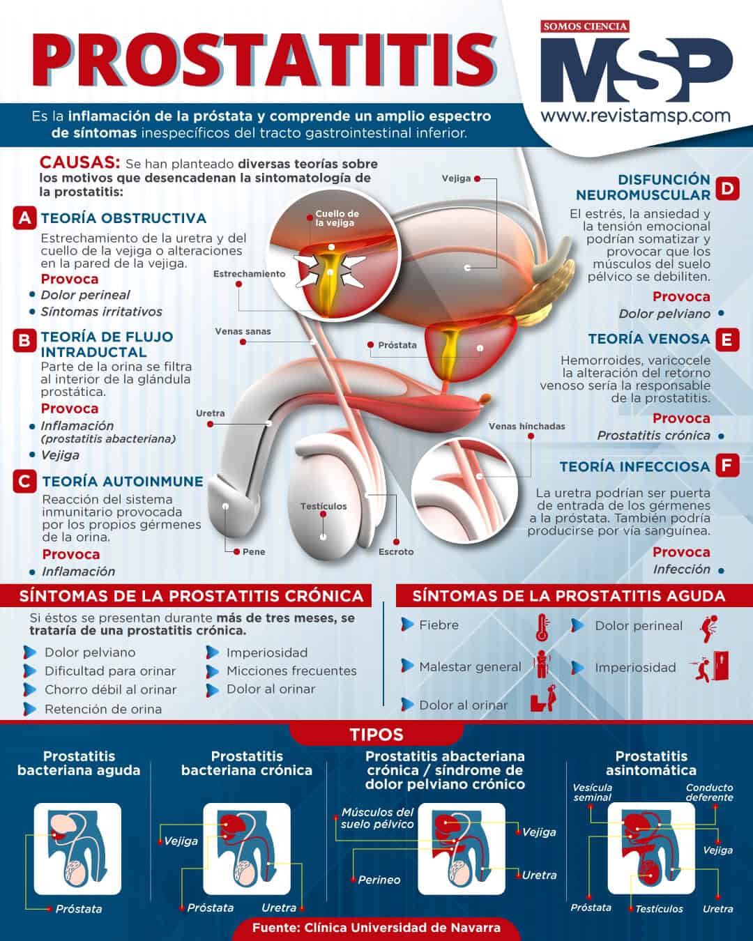 PROSTATITIS
