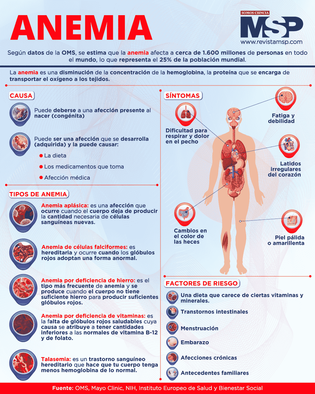 ANEMIA