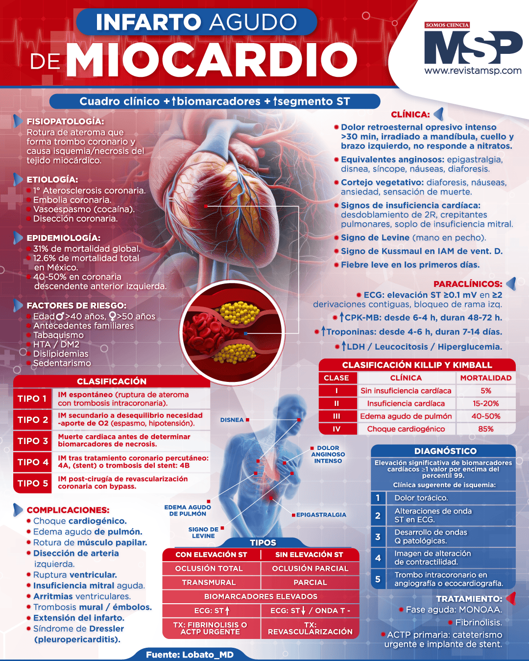 INFARTO AGUDO DE MIOCARDIO
