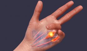 Dr. José Yovín Vargas: Un médico comprometido con la Salud Pública de ...