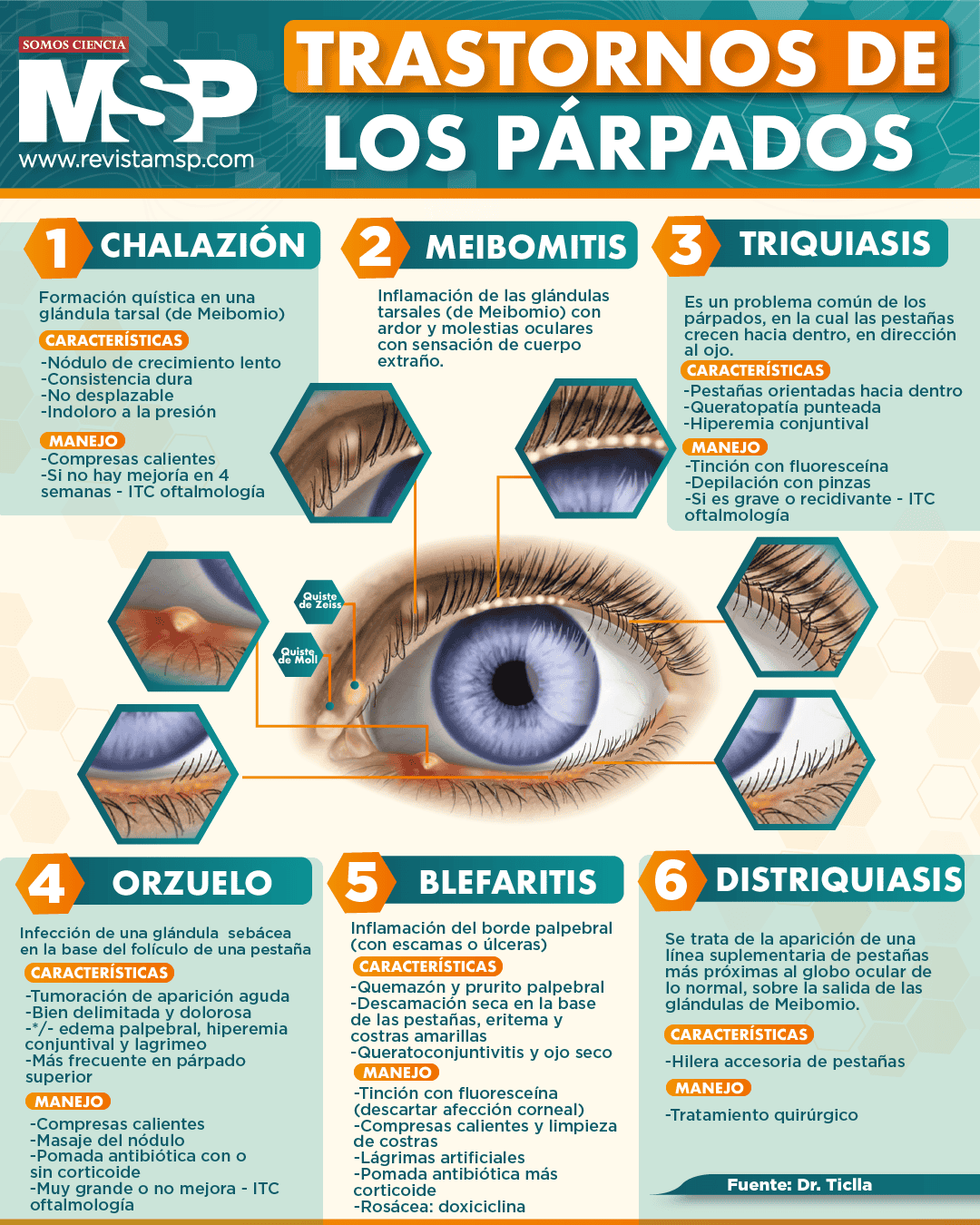 Trastornos de los párpados